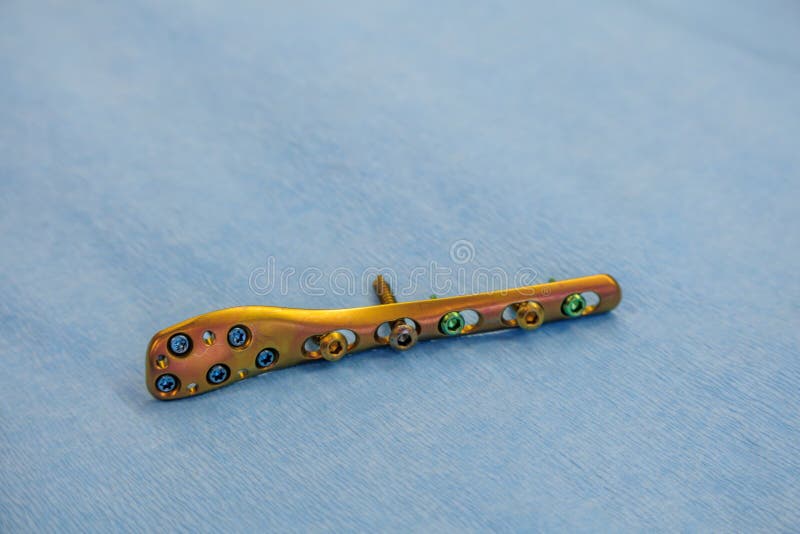 Titanium Surgical Plate and Titanium Screws for the Treatment of a ...