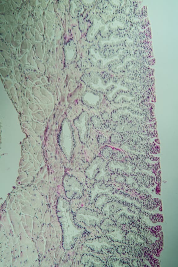 Toad Cross Section through the Tongue Stock Photo - Image of ...