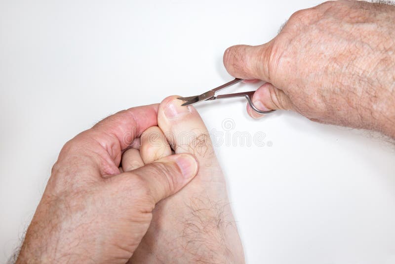 Toe nail clipping stock image. Image of toes, pedicure - 177563583