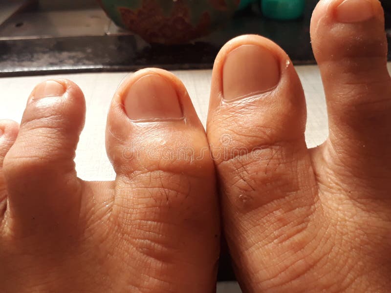 Toe Photos with Clean Nails Stock Image - Image of clean, limb: 178966221