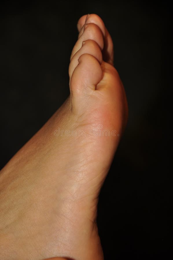 Toes. stock photo. Image of skin, body, barefoot, black - 57720888