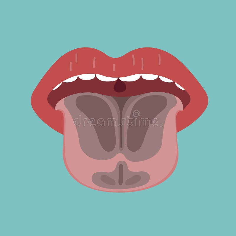 Tongue Disease, Vector of Organ Concept Stock Vector - Illustration of ...