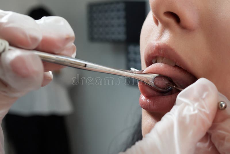 Tongue Piercing Operation Professional Holding the Jewel. Stock Image ...