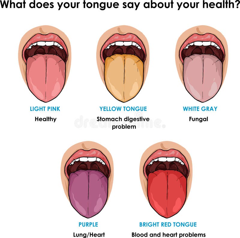 Tongue’s Health Sign Vector Illustration Set Stock Vector ...