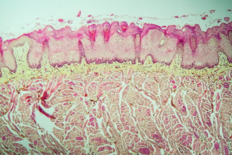 Tongue Tissue with Taste Buds Across Stock Photo - Image of histology ...