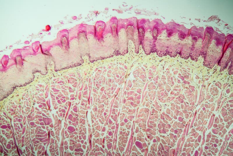 Tongue Tissue with Taste Buds Across Stock Photo - Image of histology ...