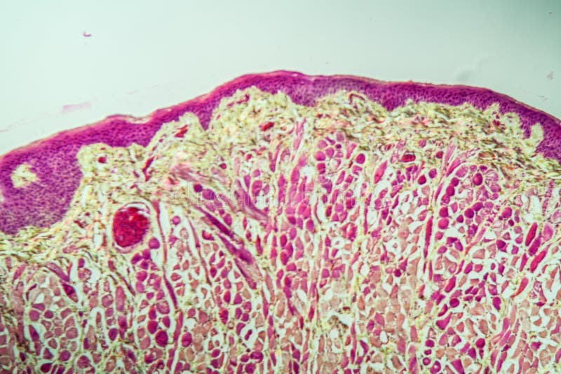 Tongue Tissue with Taste Buds Across Stock Photo - Image of histology ...