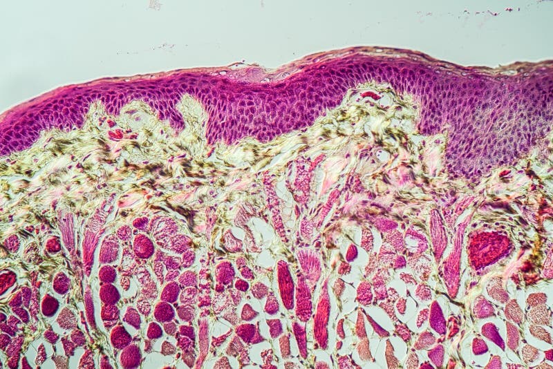 Tongue Tissue with Taste Buds Across Stock Photo - Image of tissue ...