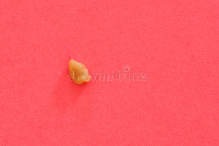 Tonsil Stone Tonsillolith Stock Photos - Free & Royalty-Free Stock ...
