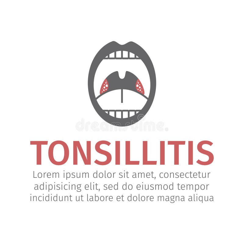 Tonsillitis Icon Vector Sign for Web Graphic. Stock Vector ...