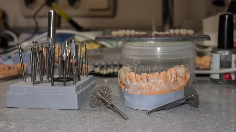 Ceramic Crown of a Tooth Based on a Plaster Model of Teeth, the Work of ...
