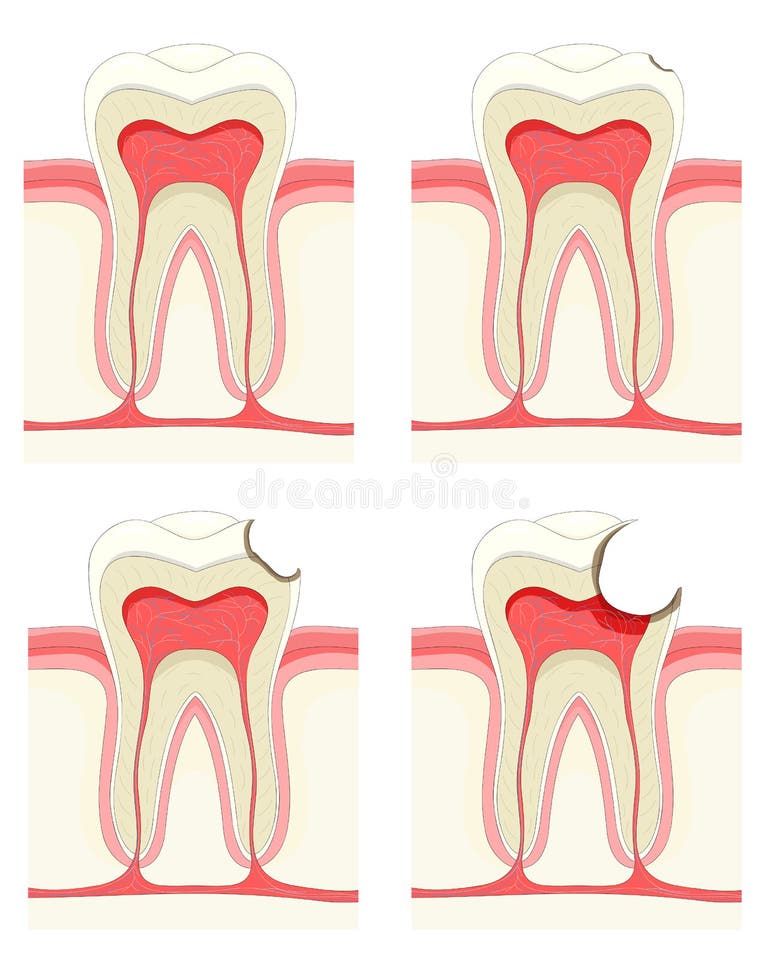 Tooth Development Stock Illustrations – 2,831 Tooth Development Stock ...