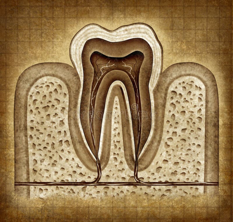 Tooth Anatomy in Grunge Texture Stock Illustration - Illustration of ...