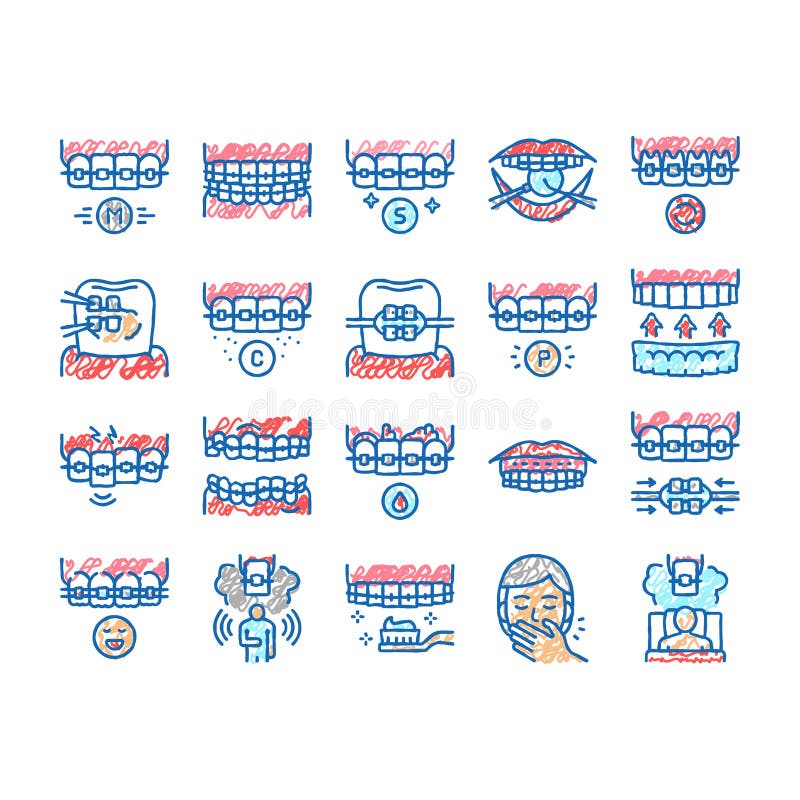 Tooth Braces Accessory Set Icons Hand Drawn Stock Illustration ...
