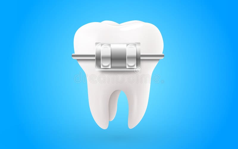 Tooth with braces. stock vector. Illustration of oral - 323418668