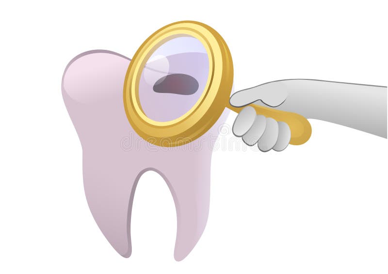 Tooth Cavity Stock Illustrations – 18,097 Tooth Cavity Stock ...
