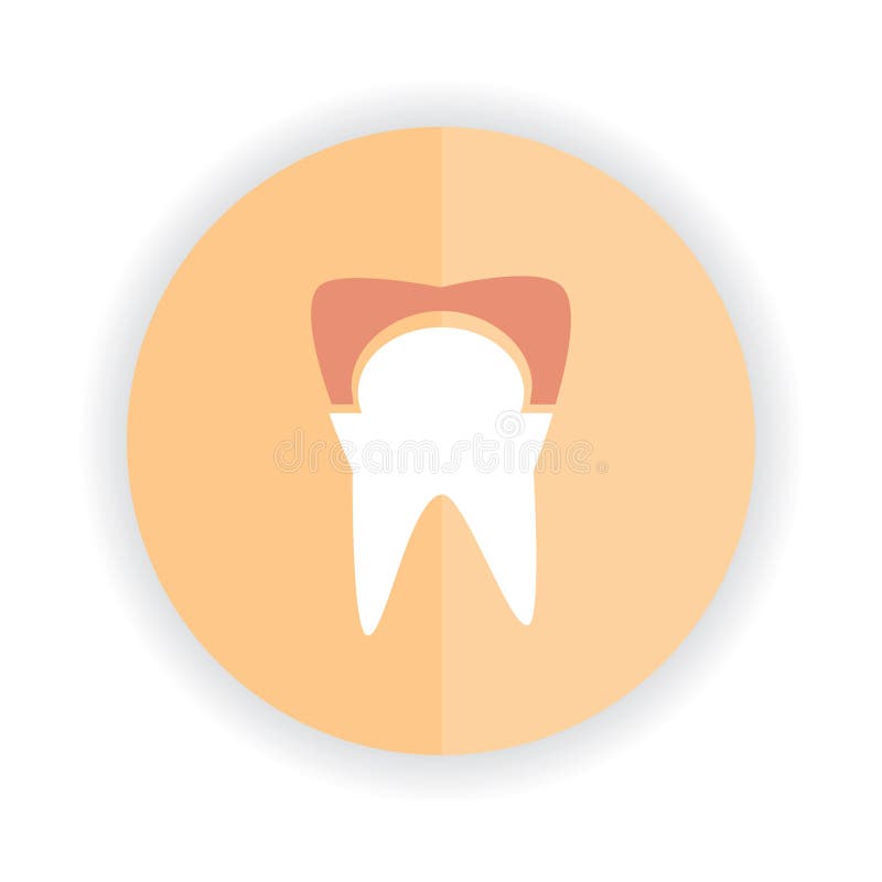 Tooth with Cavity. Vector Illustration Decorative Design Stock Vector ...