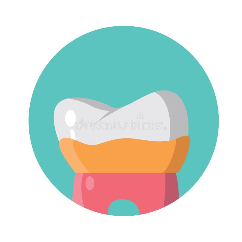 Tooth with Cavity. Vector Illustration Decorative Design Stock Vector ...