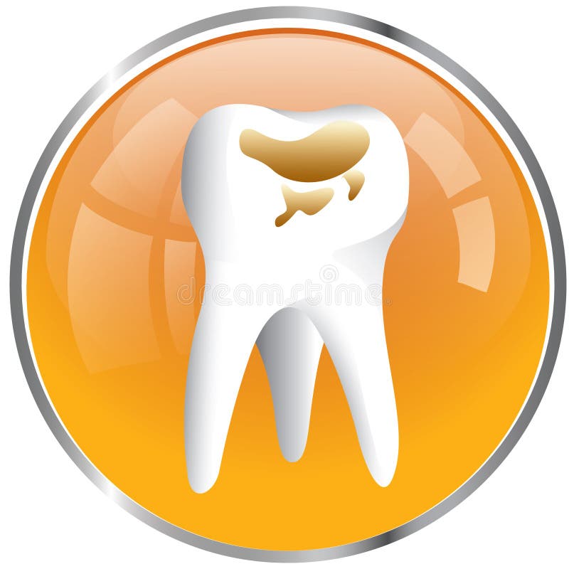 Tooth with Cavity. Vector Illustration Decorative Design Stock Vector ...