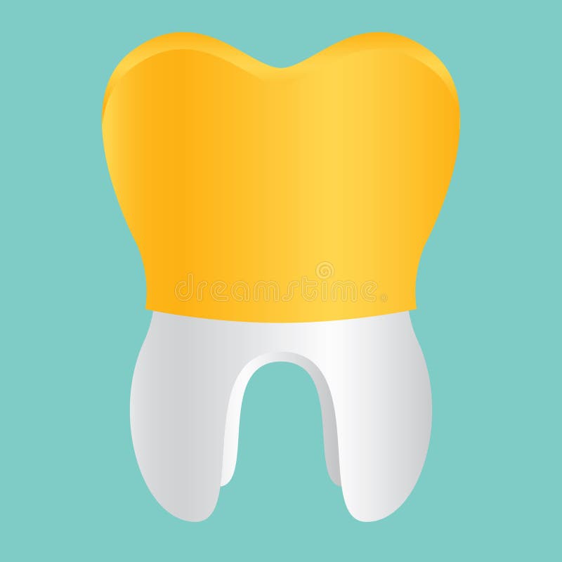 Tooth with Cavity. Vector Illustration Decorative Design Stock Vector ...