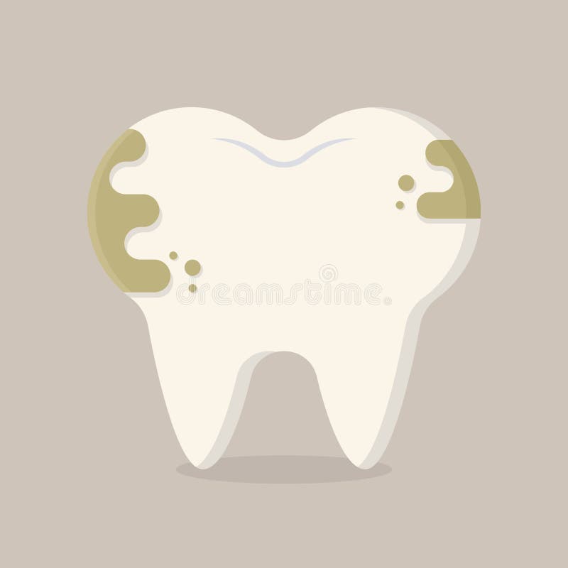 Tooth Cavity. Vector Illustration Decorative Design Stock Vector ...