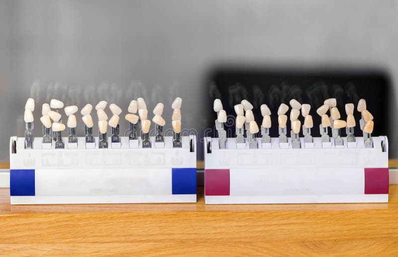 Tooth color guide stock photo. Image of patient, comparison - 61592192