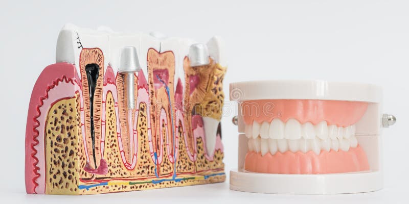 354 Cavity Side Tooth Stock Photos - Free & Royalty-Free Stock Photos ...