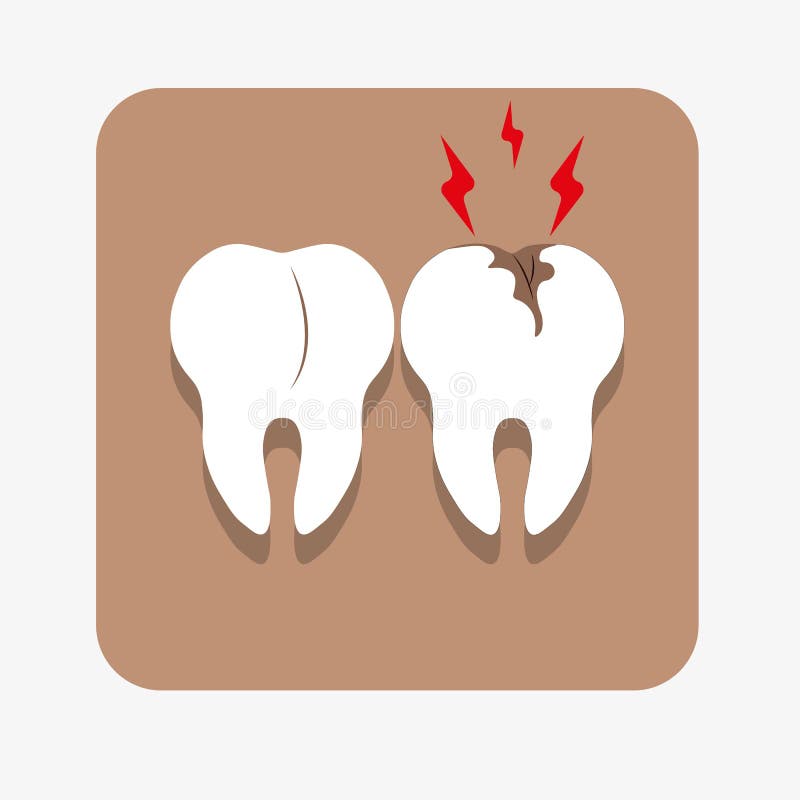 Tooth Decay, Caries Icon. Healthy Tooth and Decayed Tooth for Dental ...