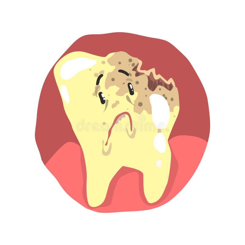 Tooth Decay Cartoon Character with Sad Face Vector Illustration Stock ...