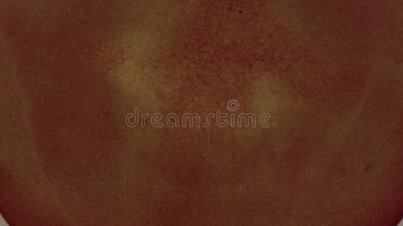 Tooth, Tooth Decay Tissue Close Up Stock Footage - Video of research ...