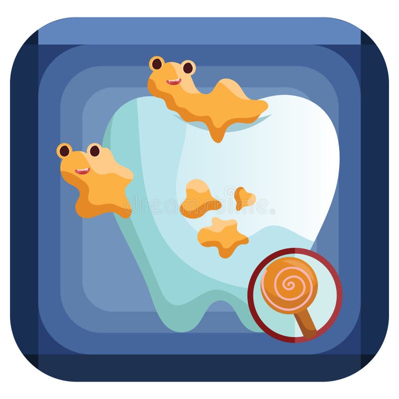 Tooth Decay. Vector Illustration Decorative Design Stock Vector ...