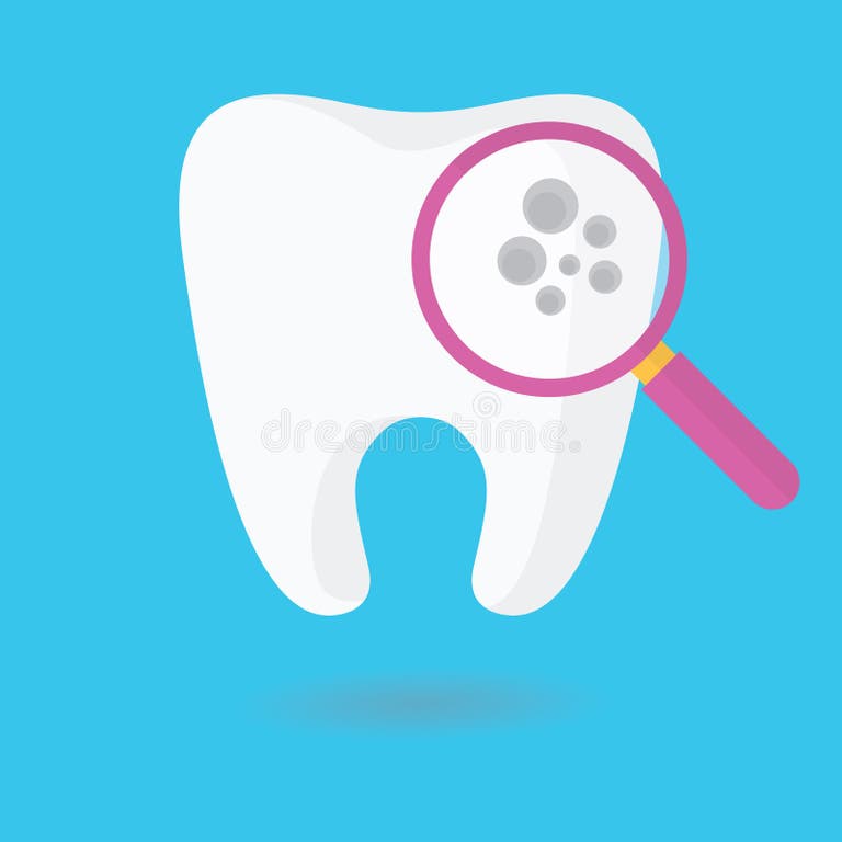 Tooth Decay. Vector Illustration Decorative Design Stock Vector ...