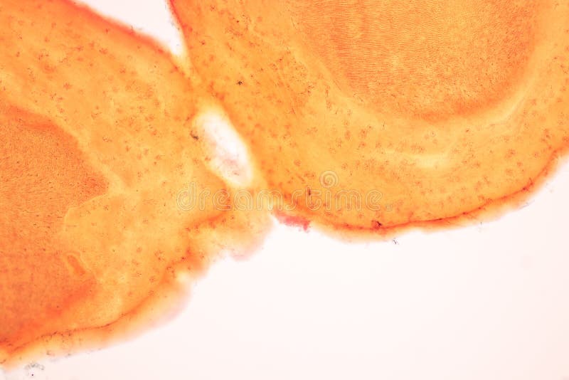 Tooth Development from Human Under Microscope . Stock Image - Image of ...