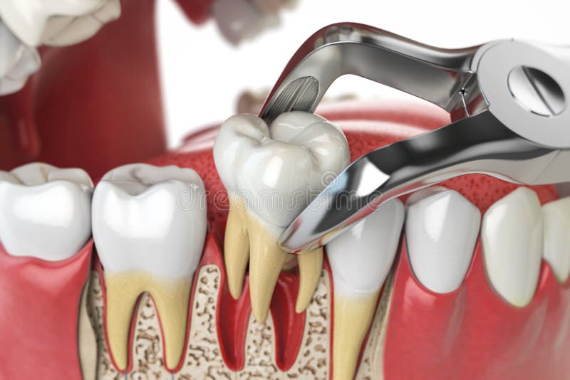 Dental Tooth Anatomy. Cross Section of Human Tooth with Infographics ...