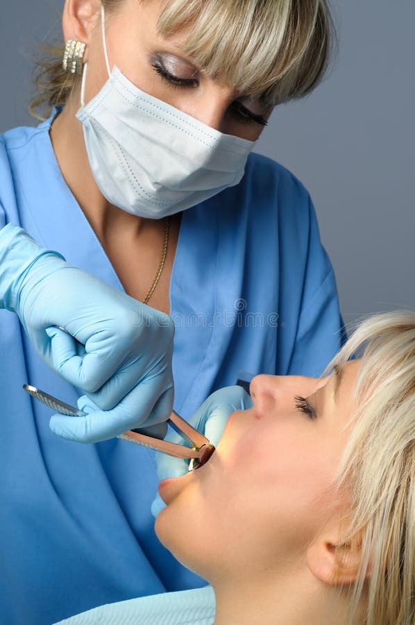 Tooth extraction stock photo. Image of human, removal - 52528830