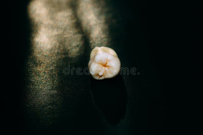 253 Bad Tooth Extraction Stock Photos - Free & Royalty-Free Stock ...