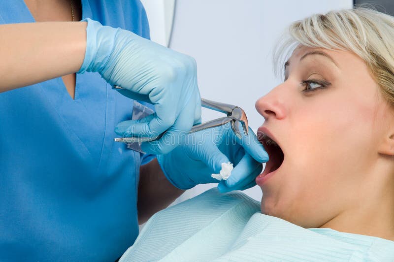 Tooth Extraction, Scared Patient Stock Image - Image of pain, female ...