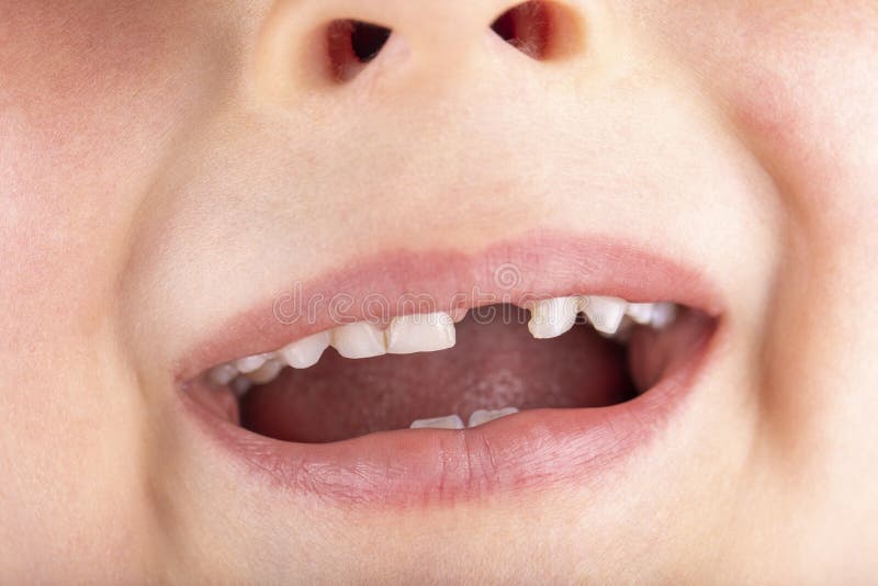 281 Pretty Gap Teeth Stock Photos - Free & Royalty-Free Stock Photos ...