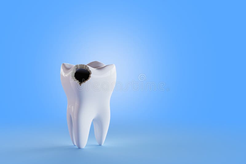 Tooth with Hole on Blue Background. Render 3d Illustration Stock ...