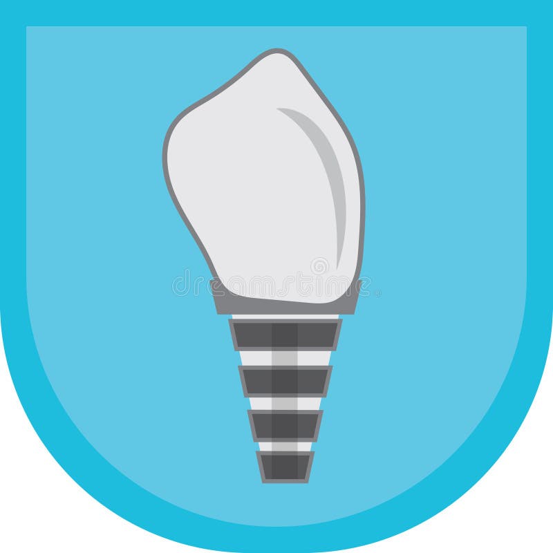 Tooth Implant. Vector Illustration Decorative Design Stock Vector ...