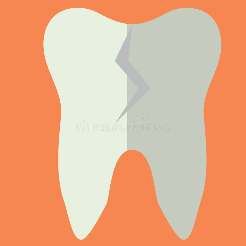 Tooth Was Lightning Made it Broken ,teeth and Tooth Concept of Dental ...