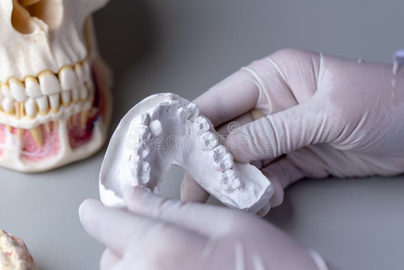 Tooth Model for Education in Laboratory. Stock Photo - Image of ceramic ...