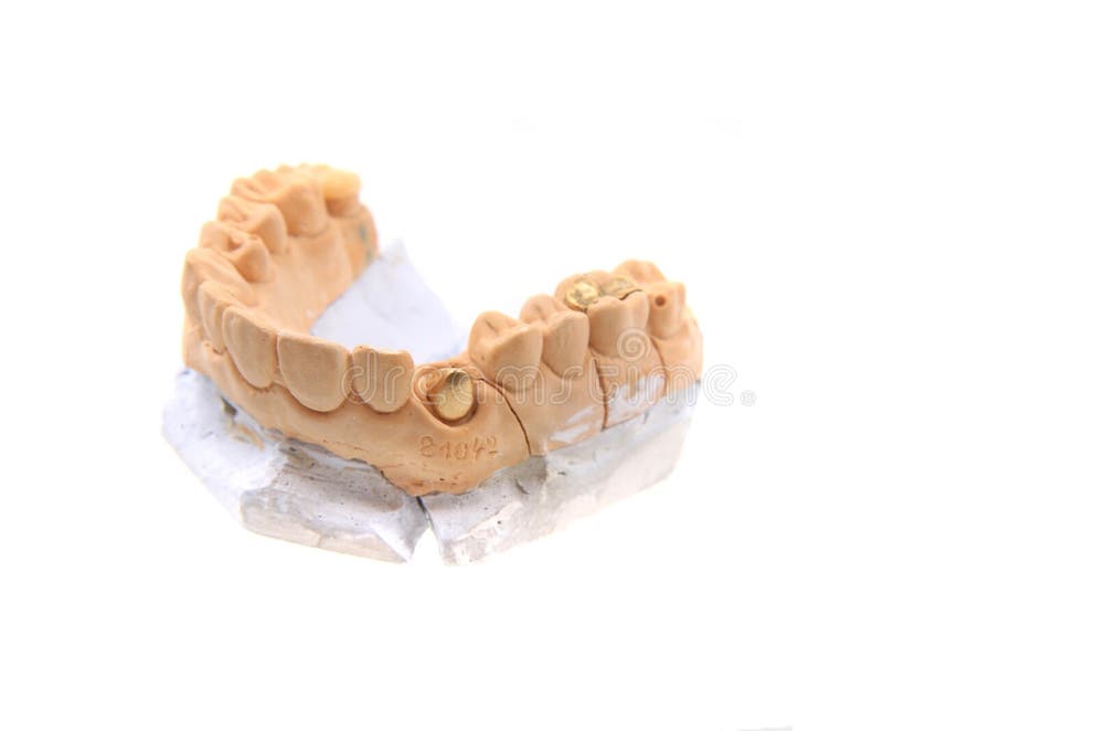 Tooth Model Objects from Dentist School Stock Photo - Image of model ...