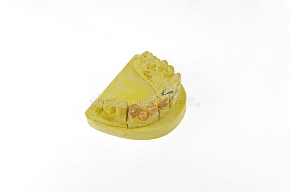 The tooth mold stock image. Image of tooth, technology - 309580911