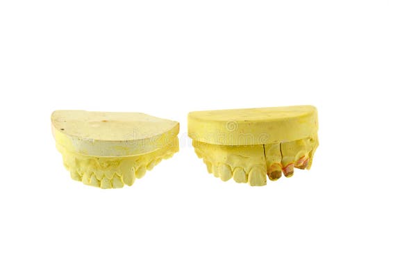 The tooth mold stock photo. Image of mold, chin, gypsum - 309580916