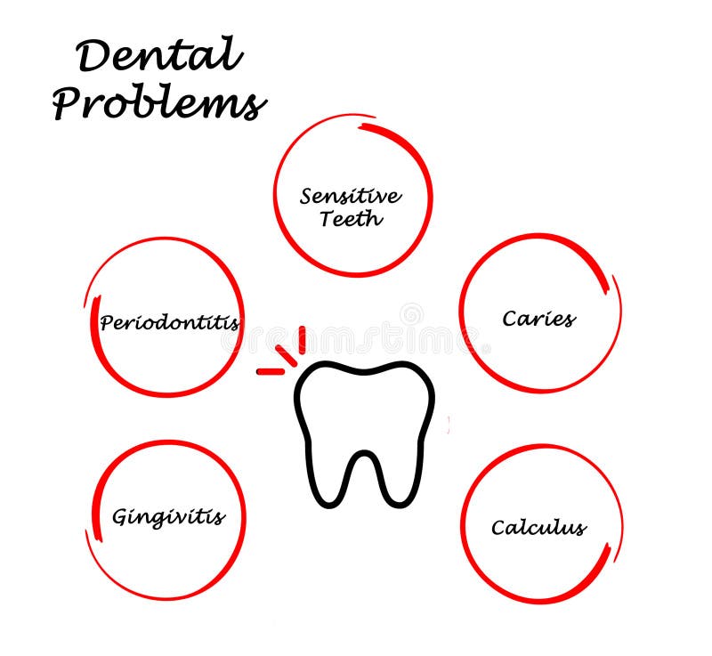 Dental Problems Diseases Infographic Set Stock Vector - Illustration of ...
