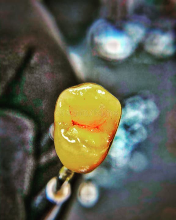 Tooth stock photo. Image of good, filter, tooth, yellow - 269367498