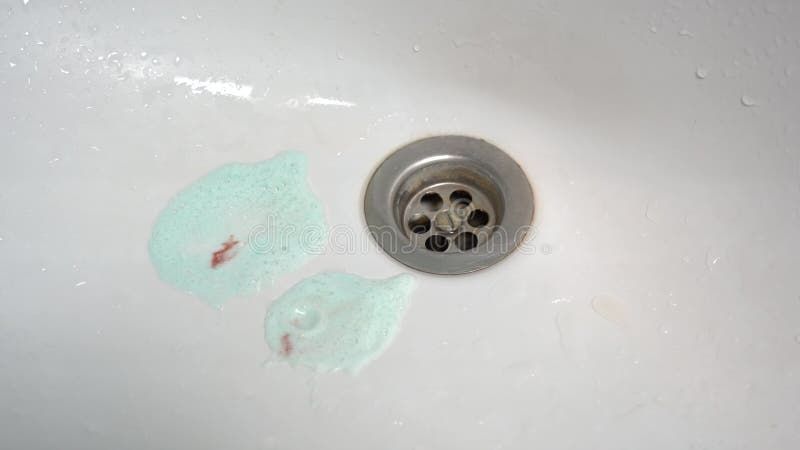 Toothpaste with Blood in the Sink. Blood when Brushing Teeth Stock ...