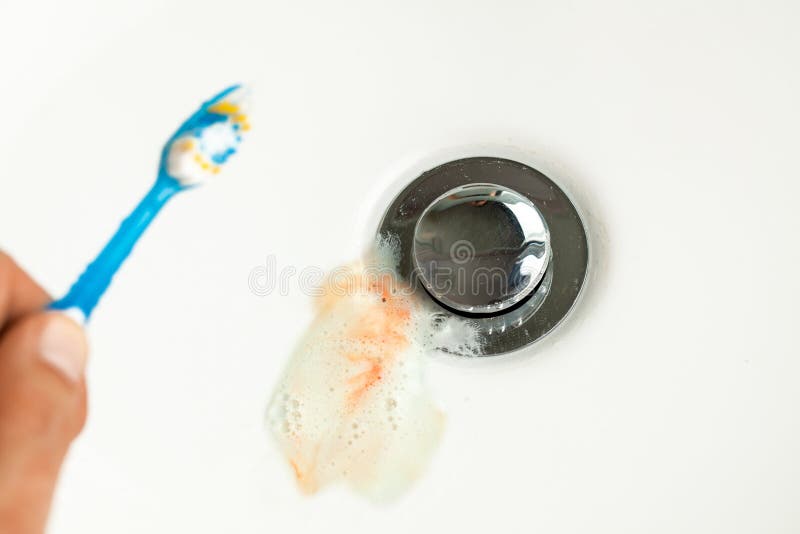Toothpaste with Blood in the Sink after Brushing Your Teeth. Bleeding ...