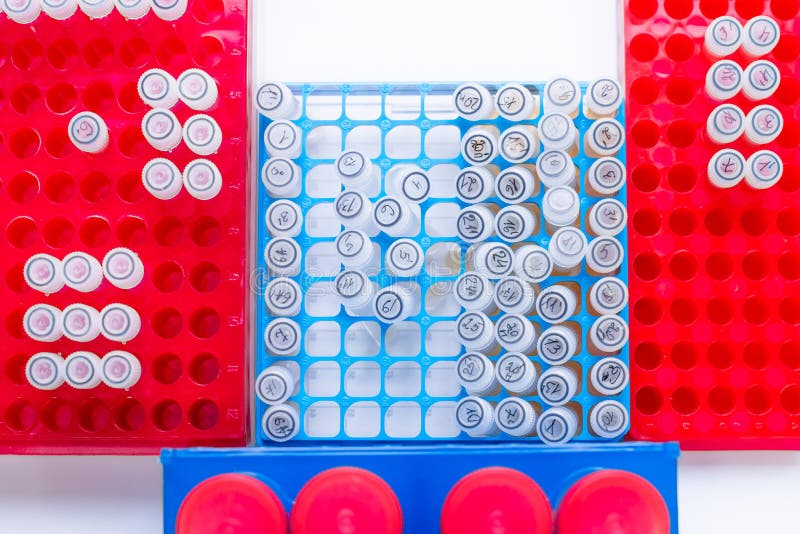 Top-down View of Test Tubes Boxes with Sample Liquied in the Medical ...